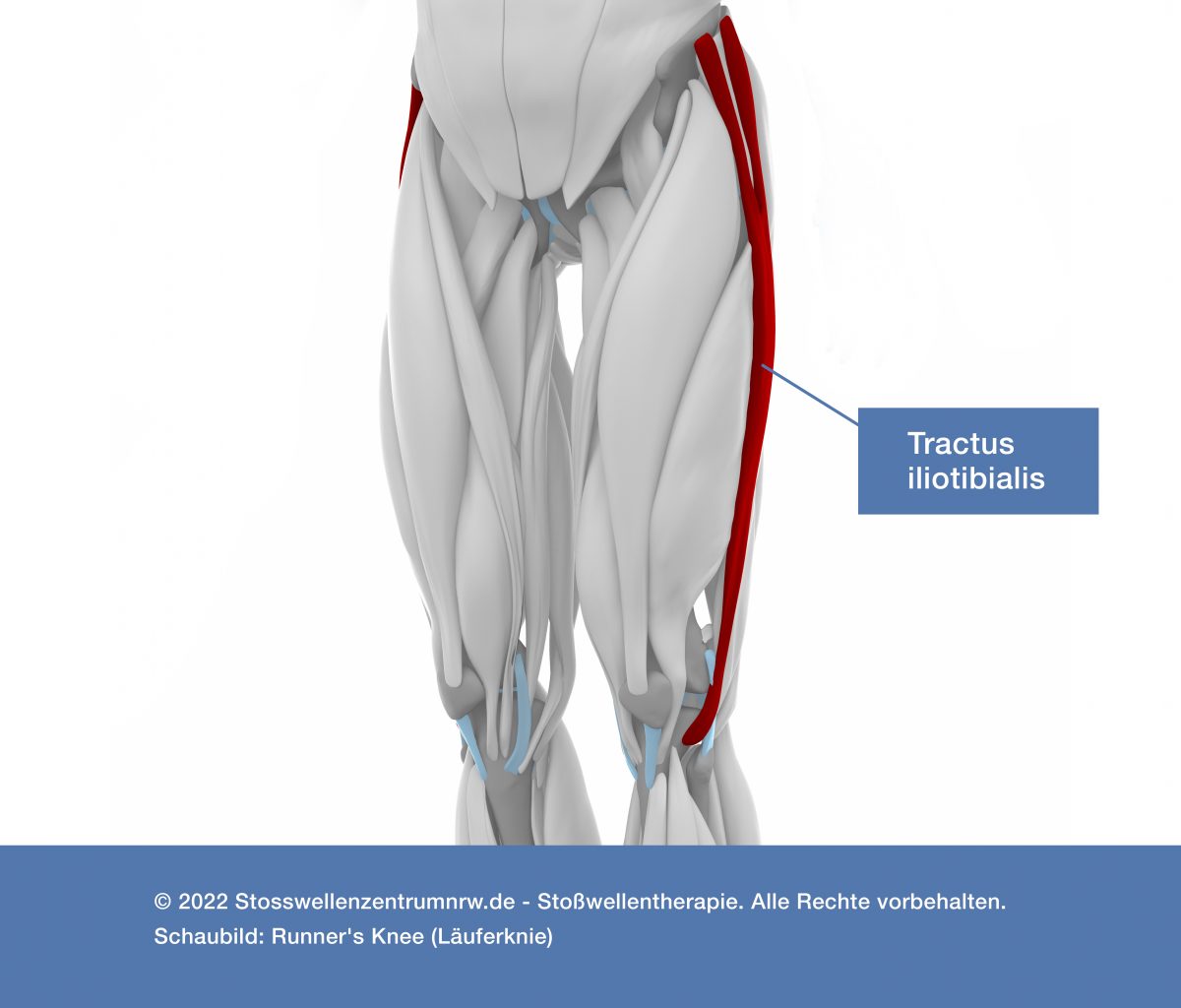 📶 Runner’s Knee - Alle Infos zur Therapie beim Läuferknie